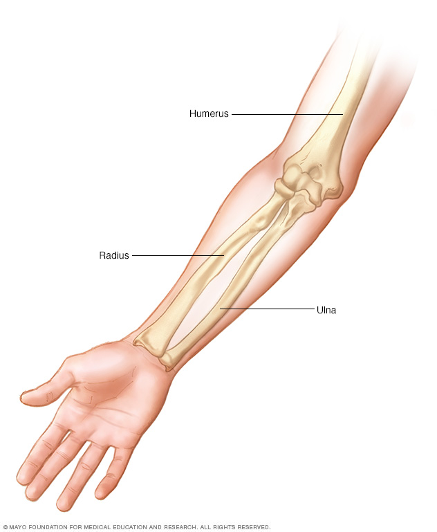 Broken Arm Disease Reference Guide Drugs