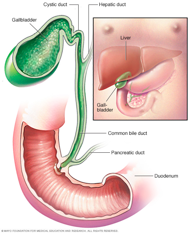Cholangiocarcinoma Bile Duct Cancer Disease Reference Guide