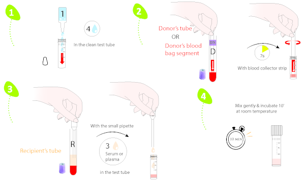  Major Crossmatch Procedure Major Crossmatching Procedure PPT 2019 02 08